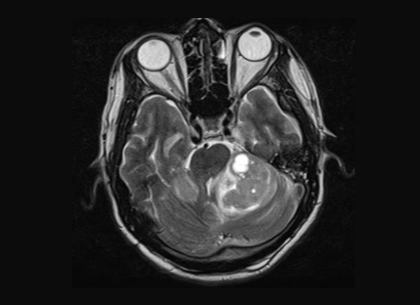 SBNR – Sociedade Brasileira de Neurorradiologia Diagnóstica e Terapêutica